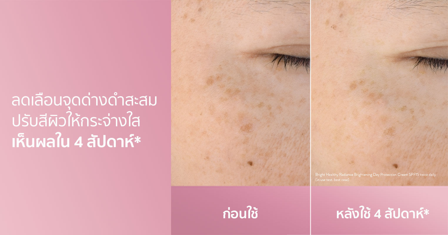 Tips for Your Sensitive Skin Care Routine | Cetaphil US